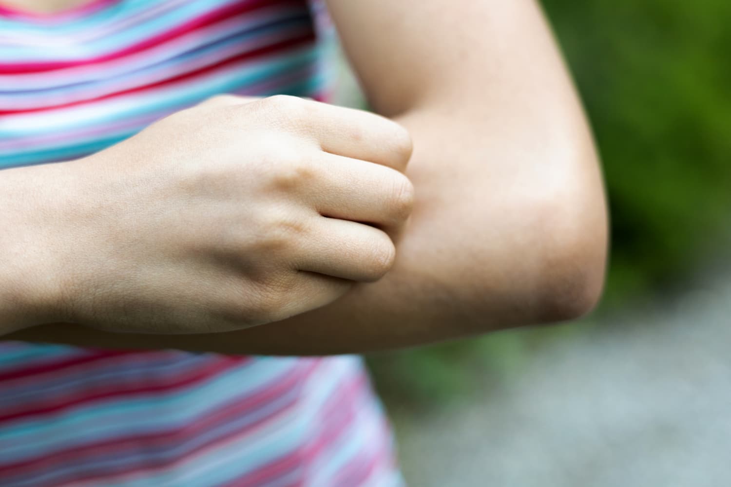 Amazon Quitch Bug Bite Itch Relief Patches Review | Apartment Therapy