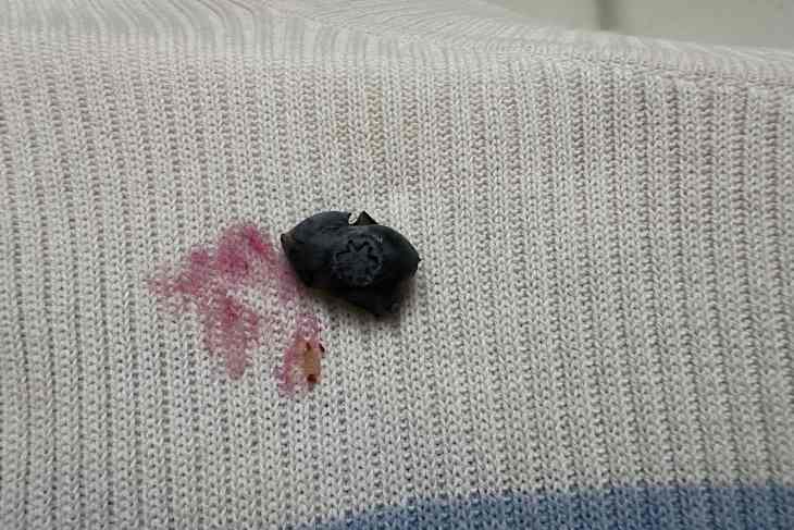 How Baby Shampoo Removes Clothing Stains | Apartment Therapy